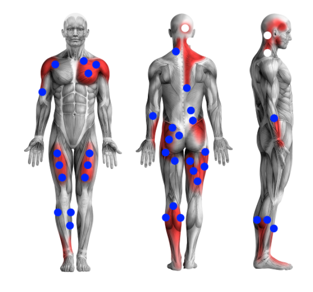 Formation trigger point - Coach Athlete Performance